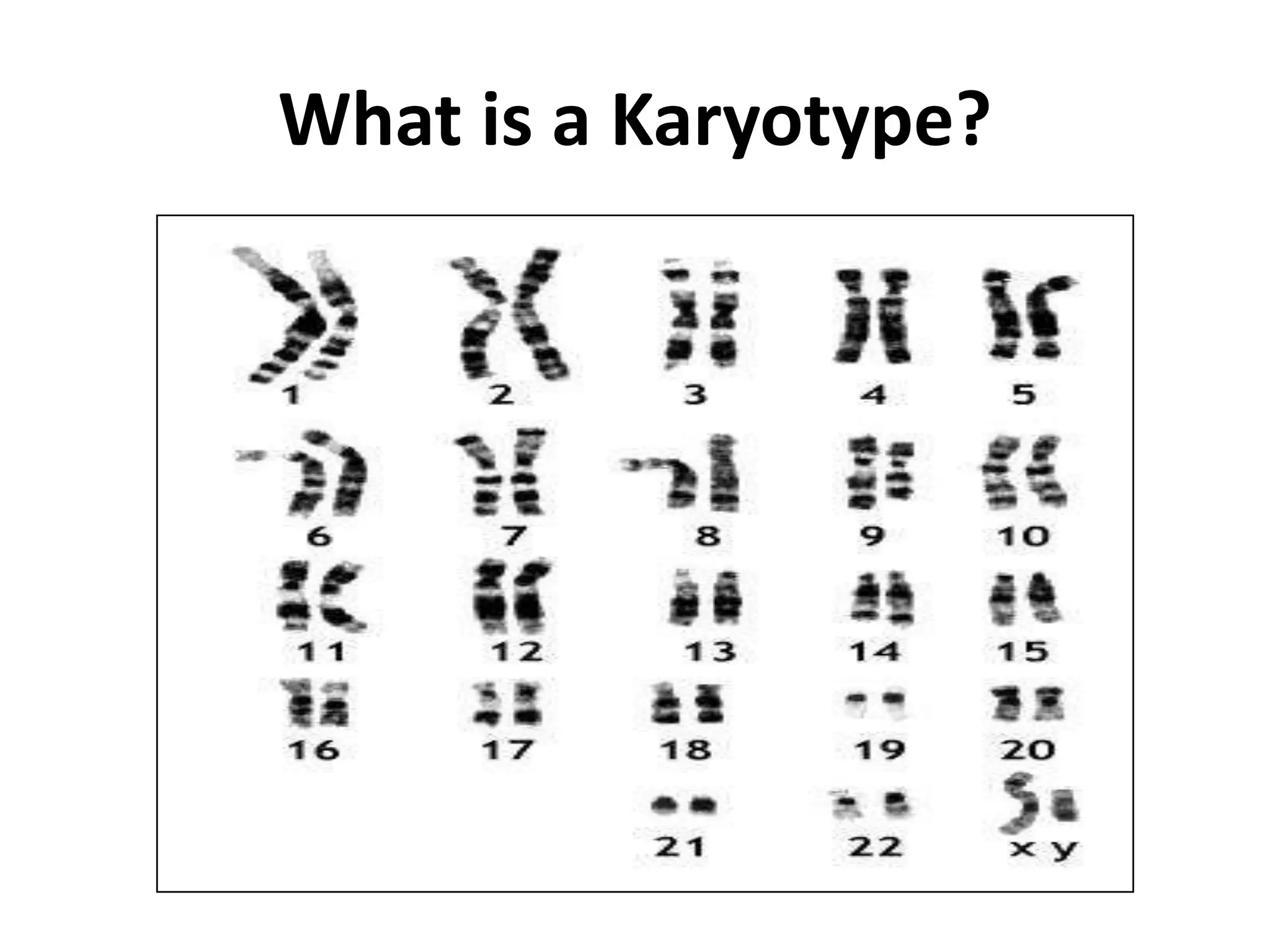 Karyotype and FISH | PPTX