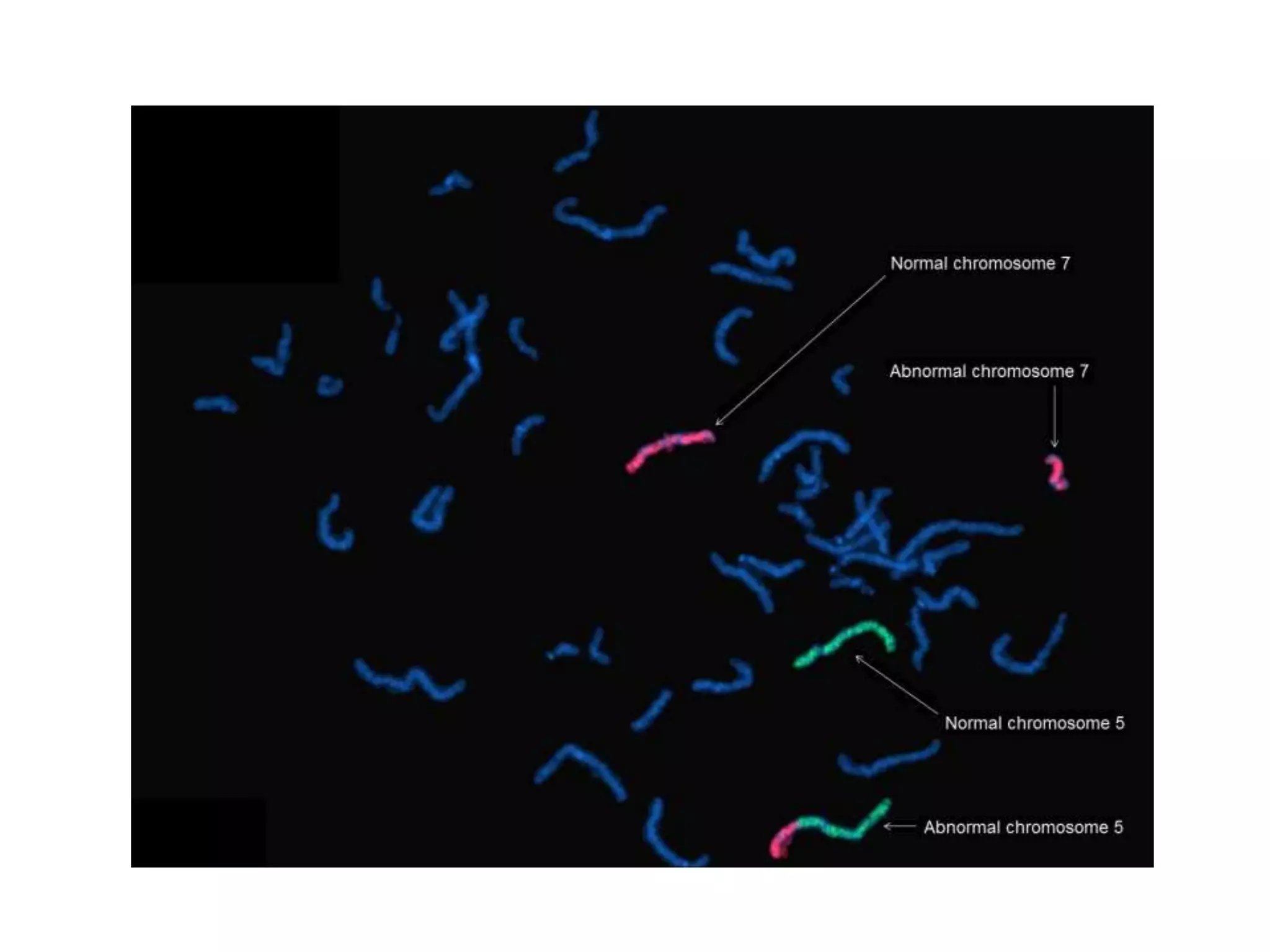 Karyotype and FISH | PPTX