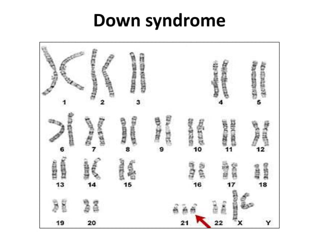 Karyotype and FISH | PPTX
