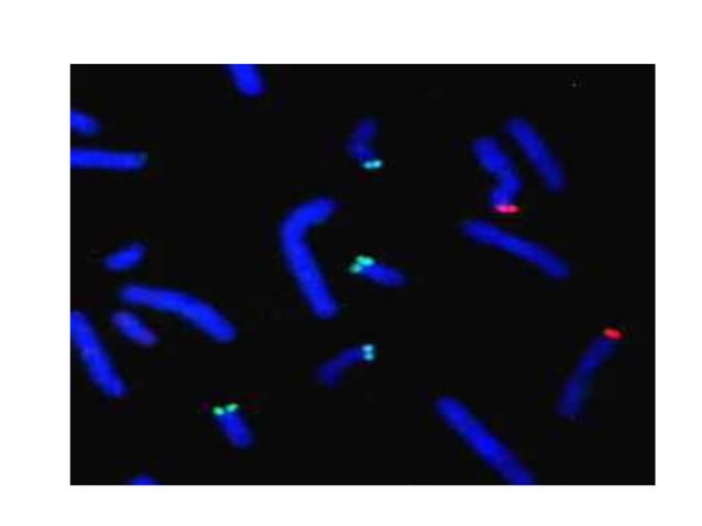 Karyotype and FISH | PPTX