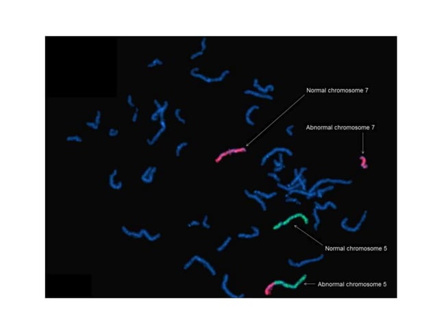 Karyotype and FISH | PPTX