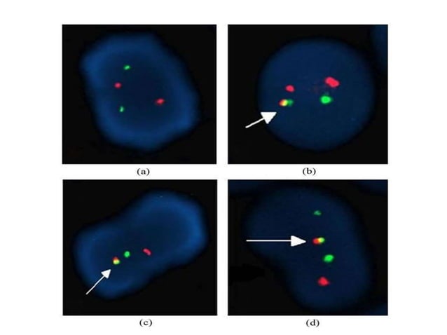 Karyotype and FISH | PPTX