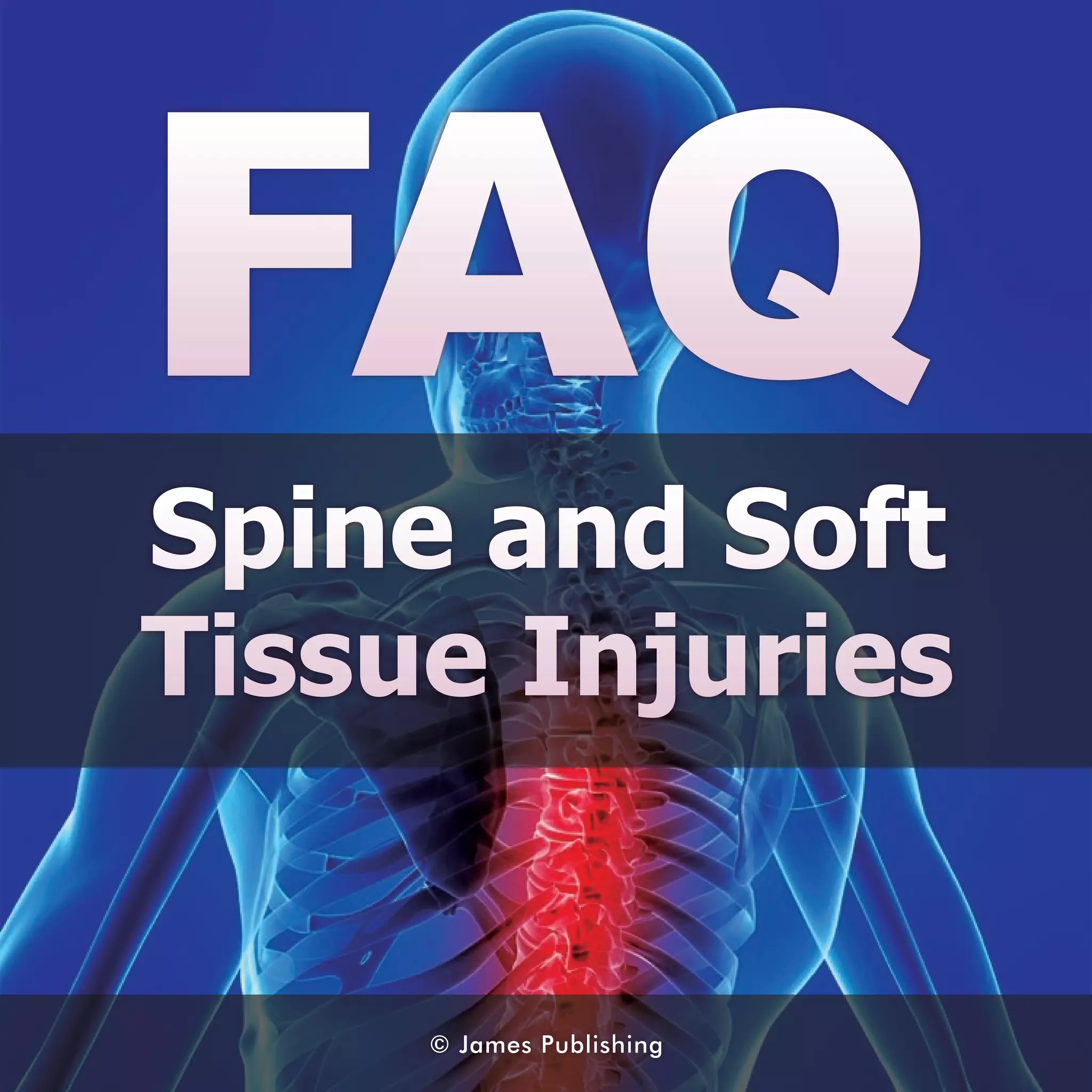 FAQ spine and soft tissue injuries | PDF