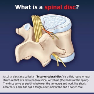 FAQ spine and soft tissue injuries | PDF