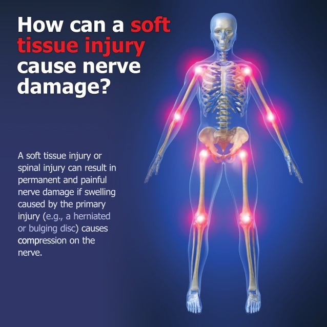 FAQ spine and soft tissue injuries