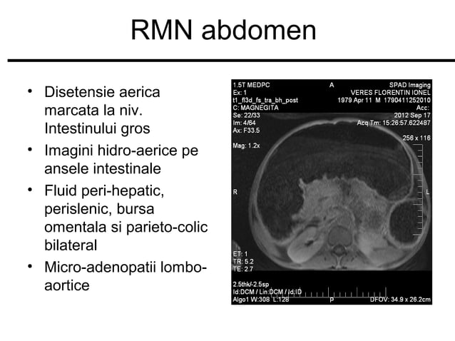 Sindrom ocluziv cronic. Caz clinic | PPT