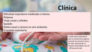 Síndrome de distres respiratorio del pretermino | PPTX