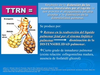 Sdr2 Ttrn Modificado | PPT