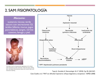 SDRA neonatal_AUherek.pdf