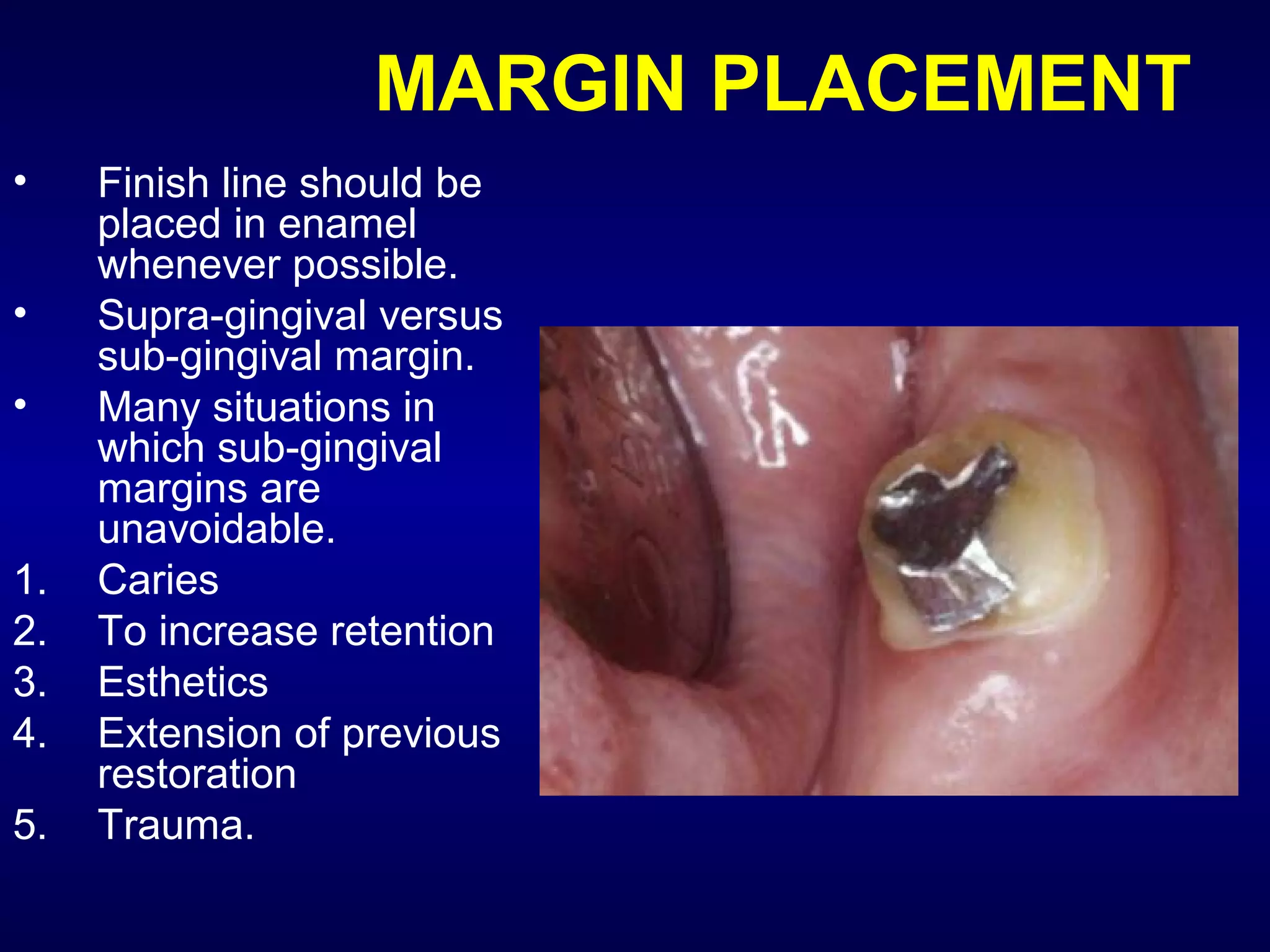 prin of tooth prep | PPT