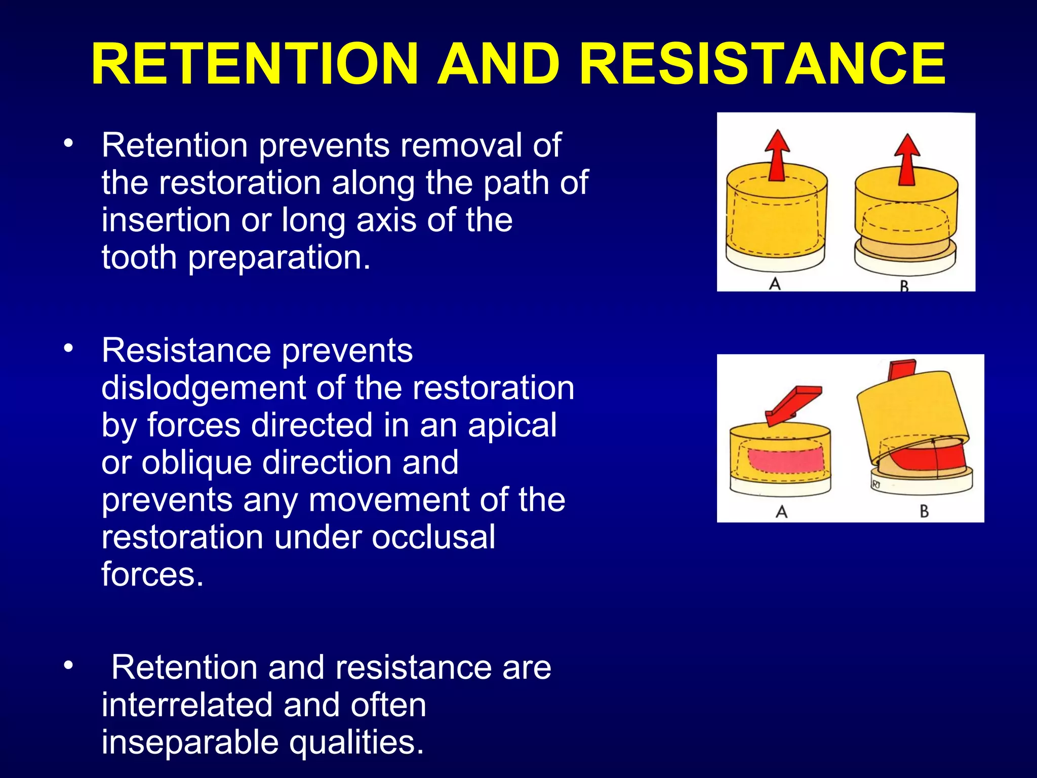 prin of tooth prep | PPT