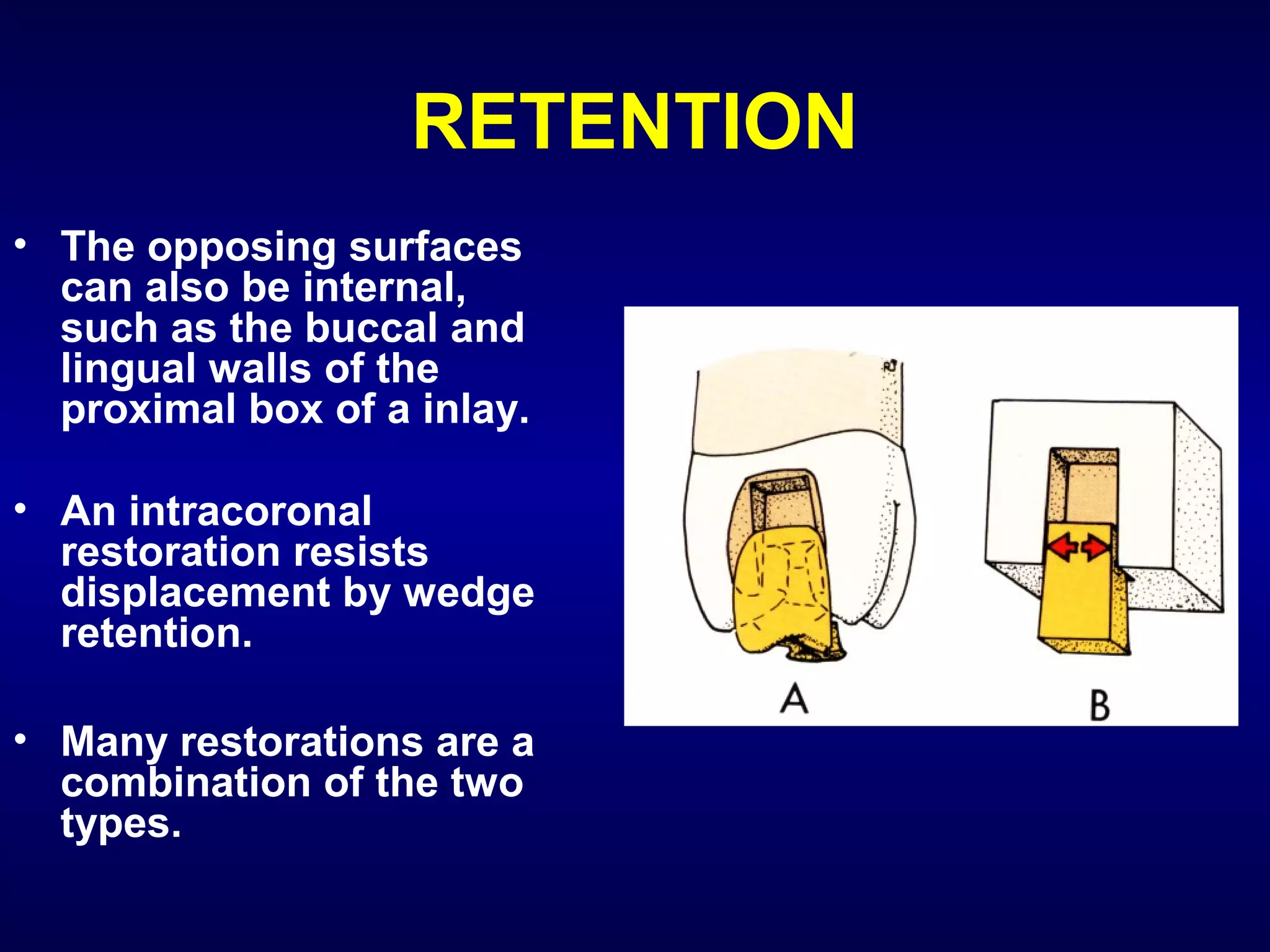 prin of tooth prep | PPT