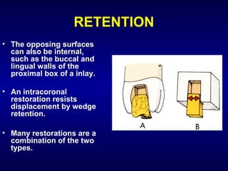 prin of tooth prep | PPT | Oral care | Personal Care