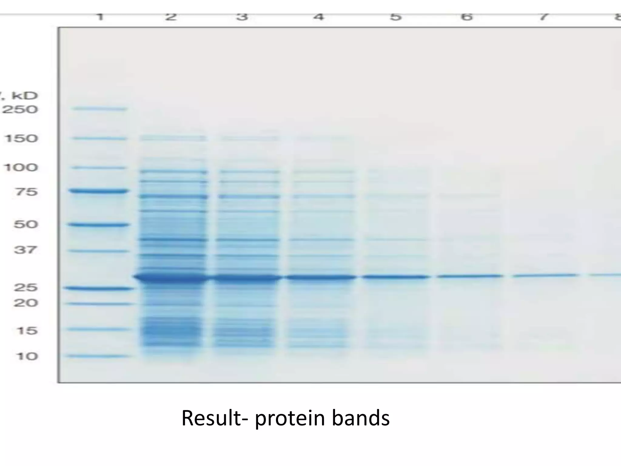 Sds page electrophoresis | PPTX