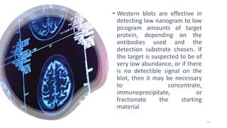 SDS PAGE, WESTERN BLOTTING, AND ELISA | PPTX