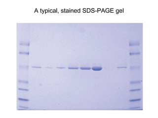 SDS Page Lecture | PPT