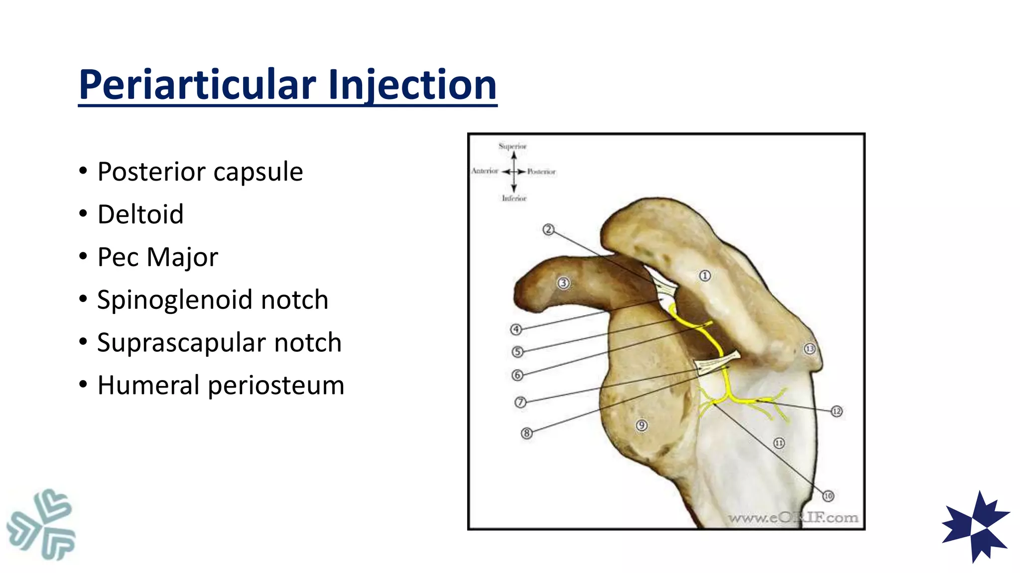 Same-Day Joint Replacement Surgery | PPTX