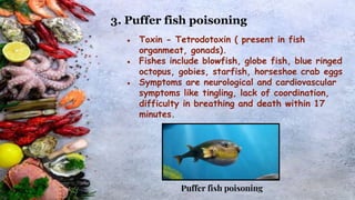 Sea Food Poisoning.pptx