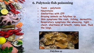 Sea Food Poisoning.pptx