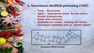 Sea Food Poisoning.pptx