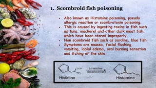 Sea Food Poisoning.pptx