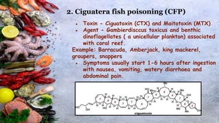 Sea Food Poisoning.pptx