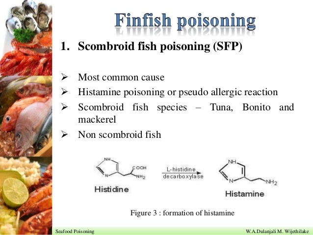 Scombroid Food Poisoning