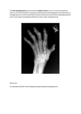 Seagul sign | DOCX