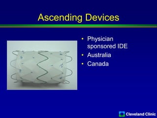 Fenestrated or branched prostheses in thoracic and abdominal aorta | PDF