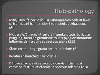 Sebaceous Adenitis | PPTX