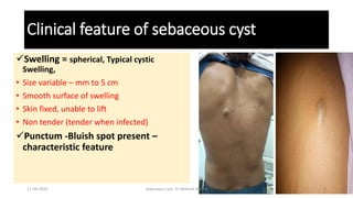 Sebaceous cyst dr mahesh 17-09-2020 | PDF