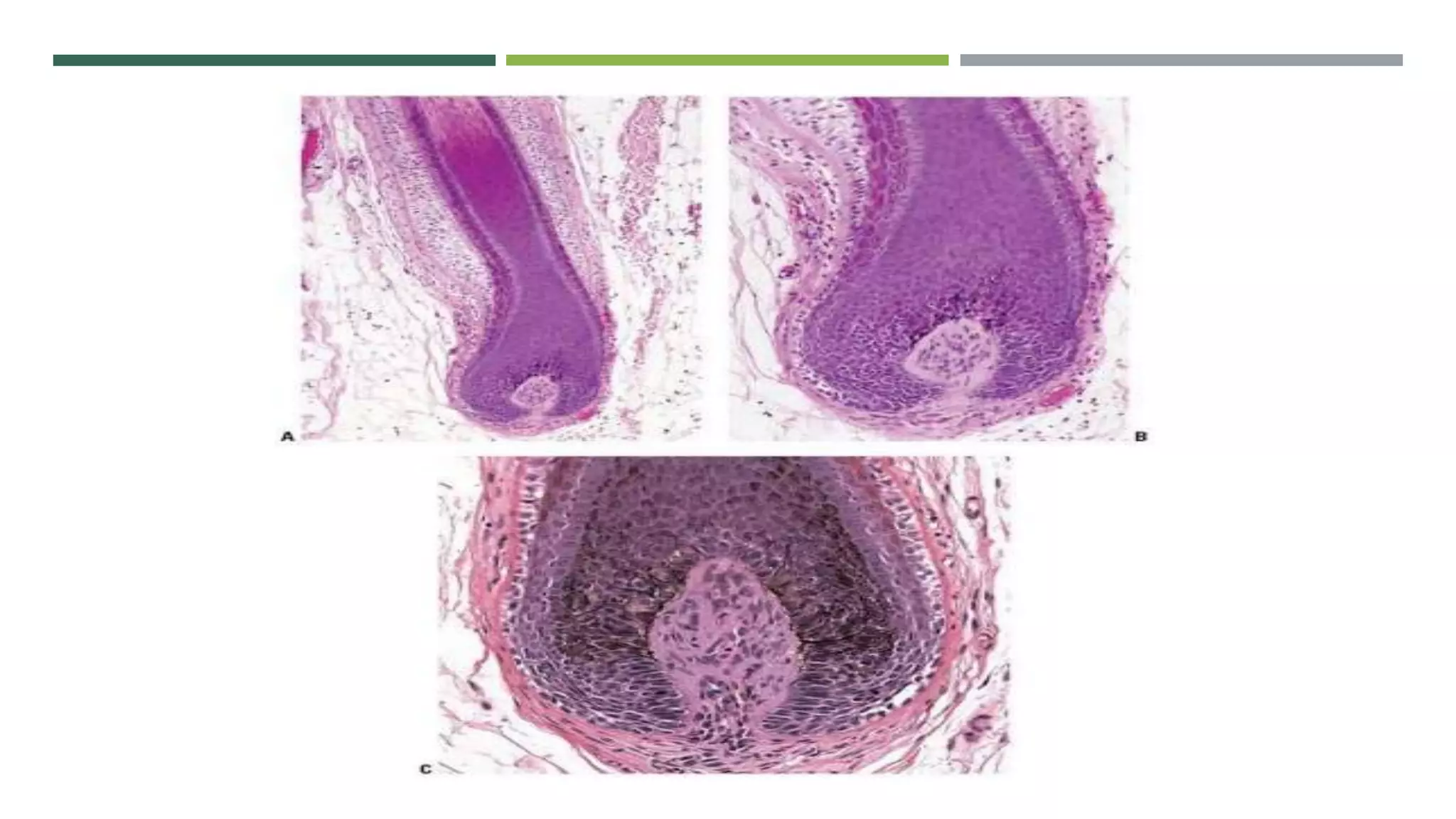 Sebaceous gland.pptx