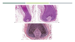 Sebaceous gland.pptx