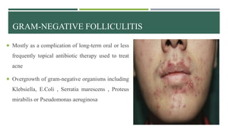 Sebaceous gland.pptx