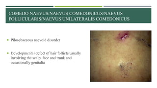 Sebaceous gland.pptx