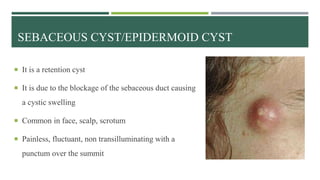 Sebaceous gland.pptx