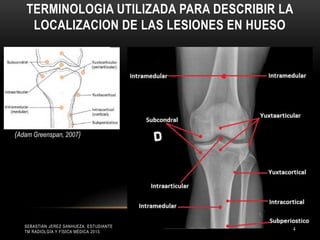 lesiones tumorales de extremidad superior e inferior | PPTX