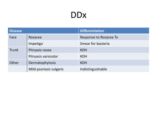 Seborrheic dermatitis | PPTX