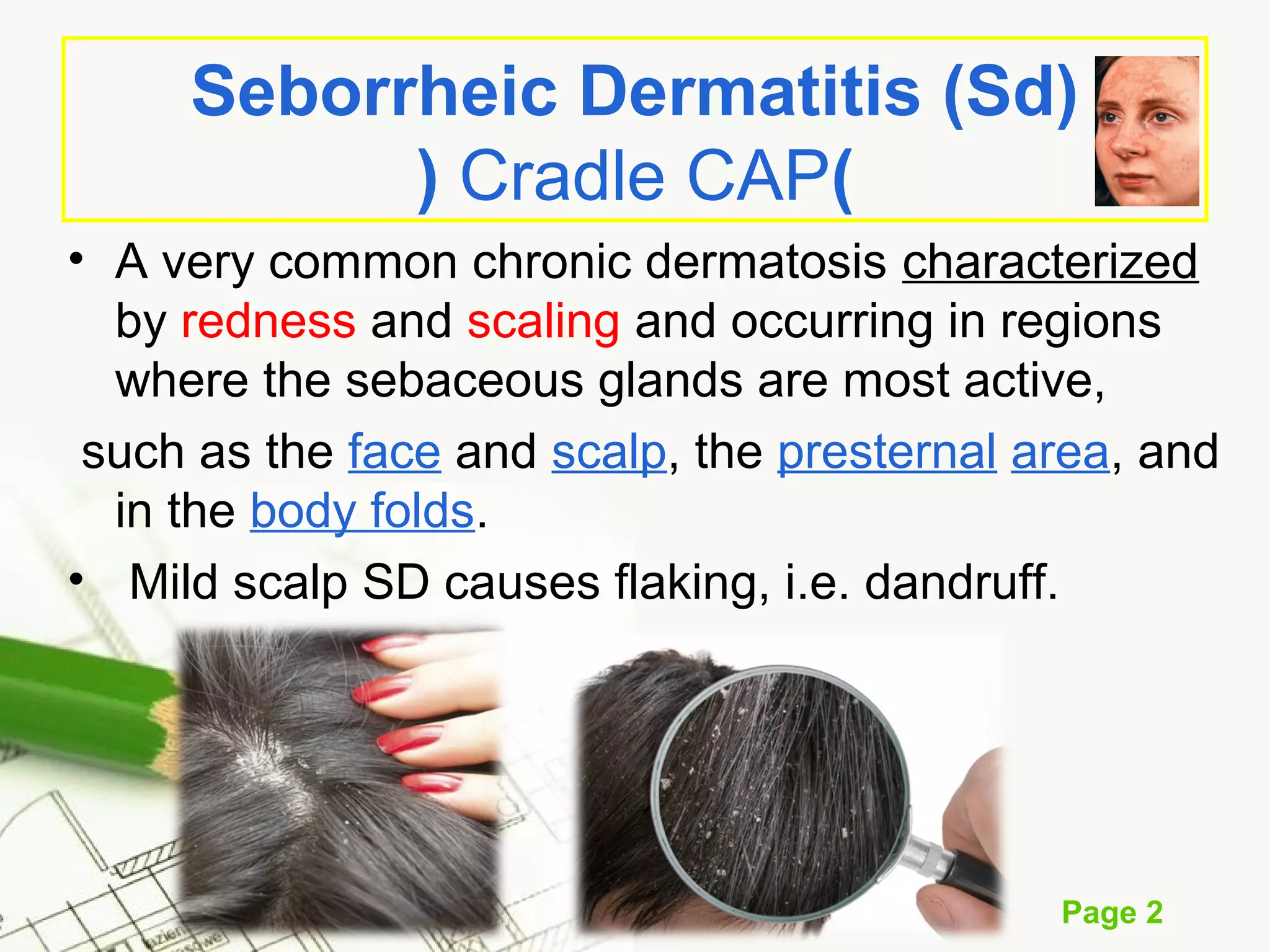 Seborrheic dermatitis | PPT