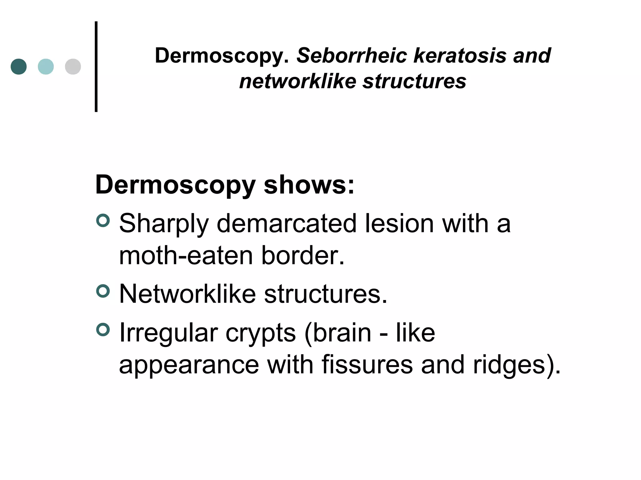 Seborrheic kertaosis | PPT
