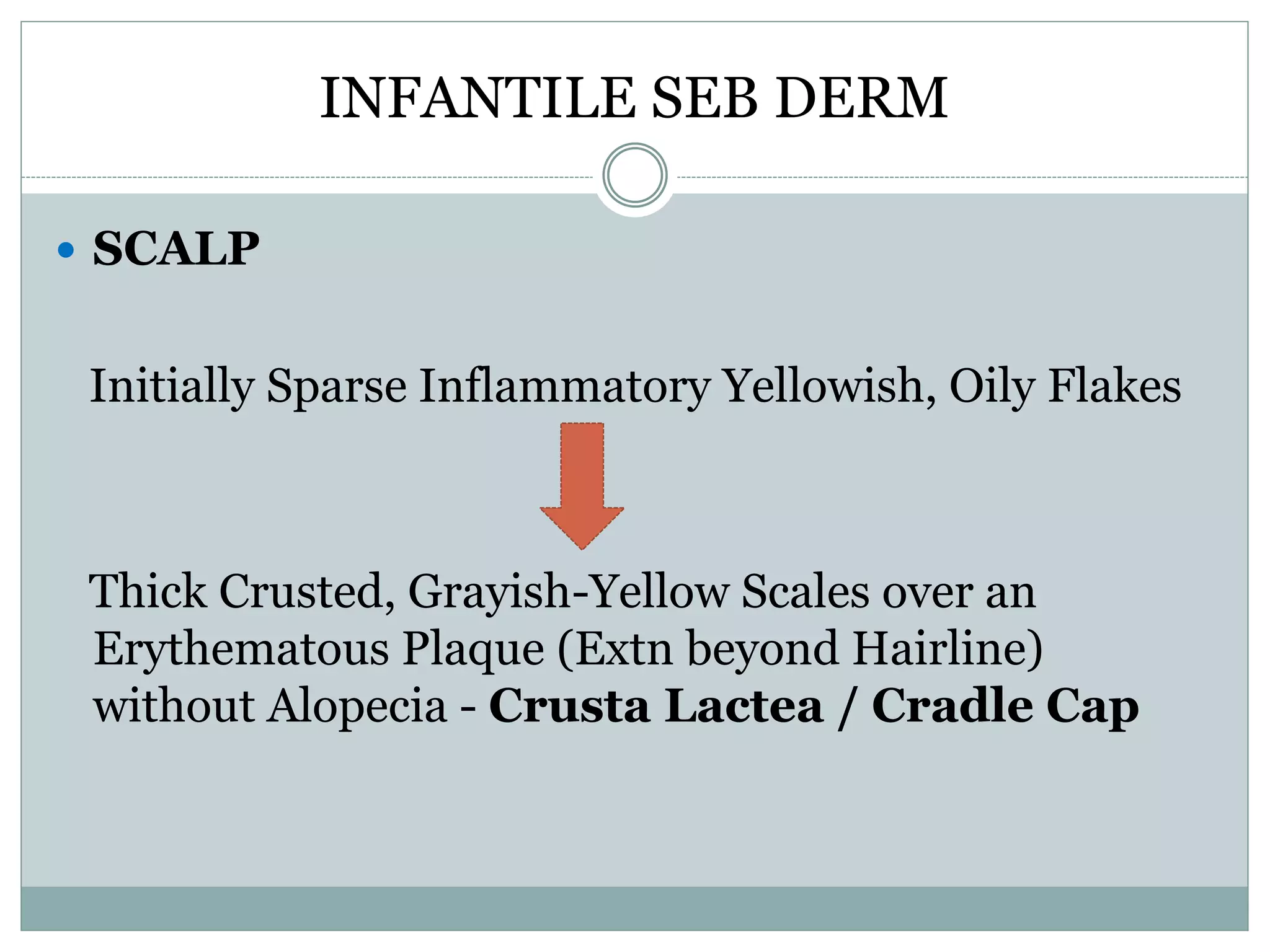 Seborrhoeic Dermatitis | PPTX