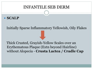 Seborrhoeic Dermatitis | PPTX