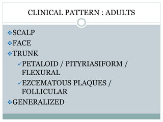 Seborrhoeic Dermatitis | PPTX