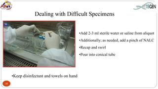 Sebsib - Processing and inoculation of sputum specimens.pdf