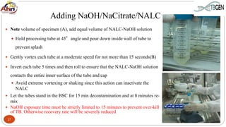 Sebsib - Processing and inoculation of sputum specimens.pdf