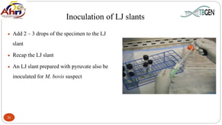 Sebsib - Processing and inoculation of sputum specimens.pdf