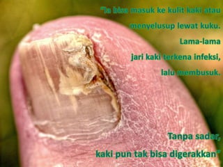 Sebutir Pasir | PPTX