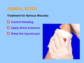 Sec1.fa10 bites and stings | PPT