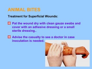 Sec1.fa10 bites and stings | PPT