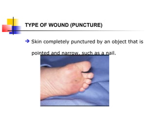 Sec1.fa4 wounds & bleeding | PPT